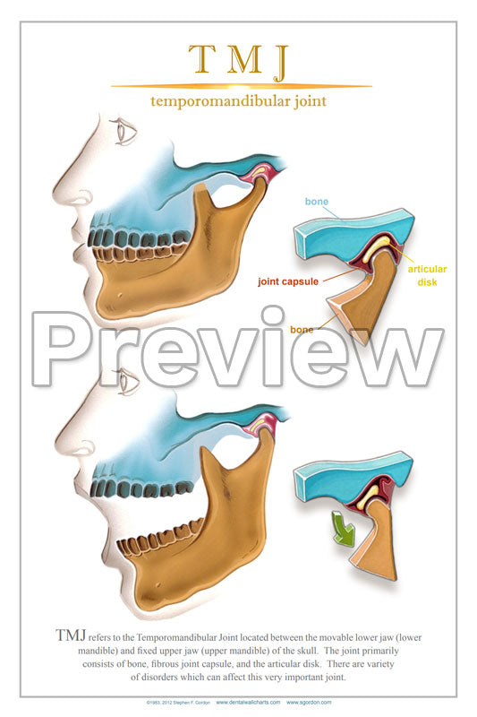 TMJ Wall Chart – Dental Flip Charts by Stephen F. Gordon