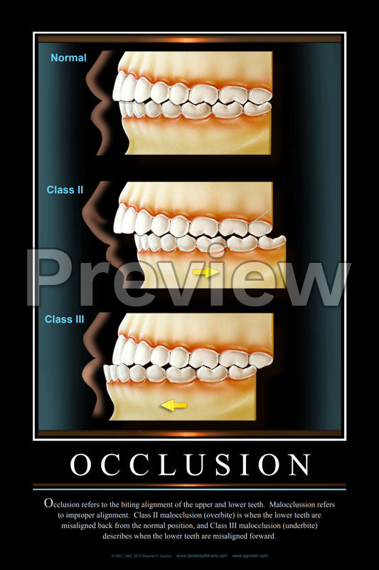 Occlusion Wall Chart – Dental Flip Charts by Stephen F. Gordon